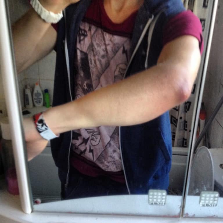 My Top 9 WORST Travel Experiences